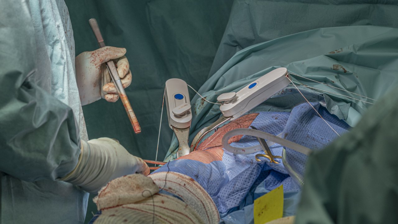 Smile Invest Joins Medtech Company MedEnvision | Merodis